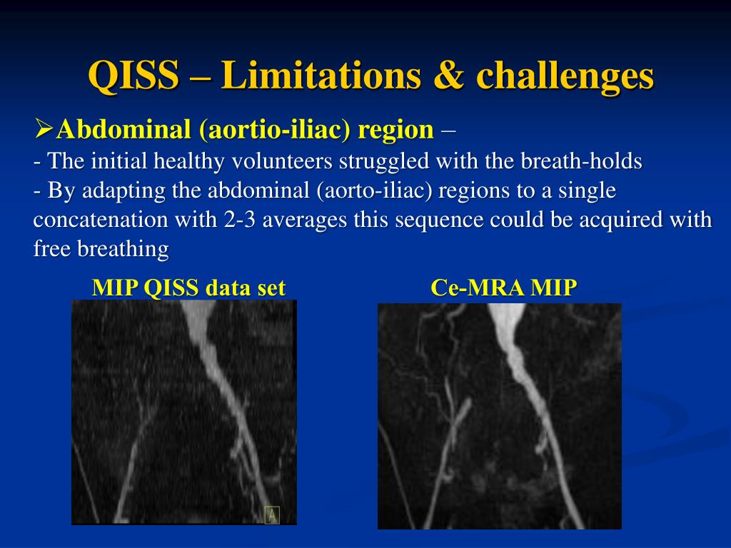 PPT - BROOKLYN 3 MRI USER GROUP Anna Marie LYNDON PowerPoint ...