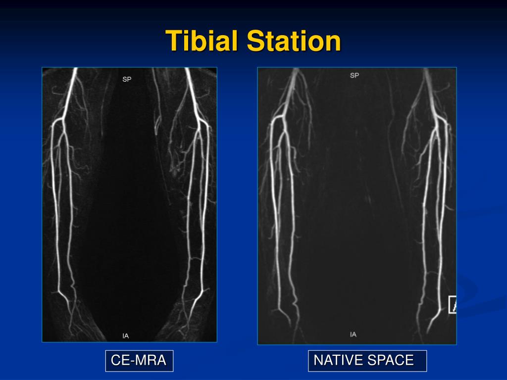 PPT - BROOKLYN 3 MRI USER GROUP Anna Marie LYNDON PowerPoint ...