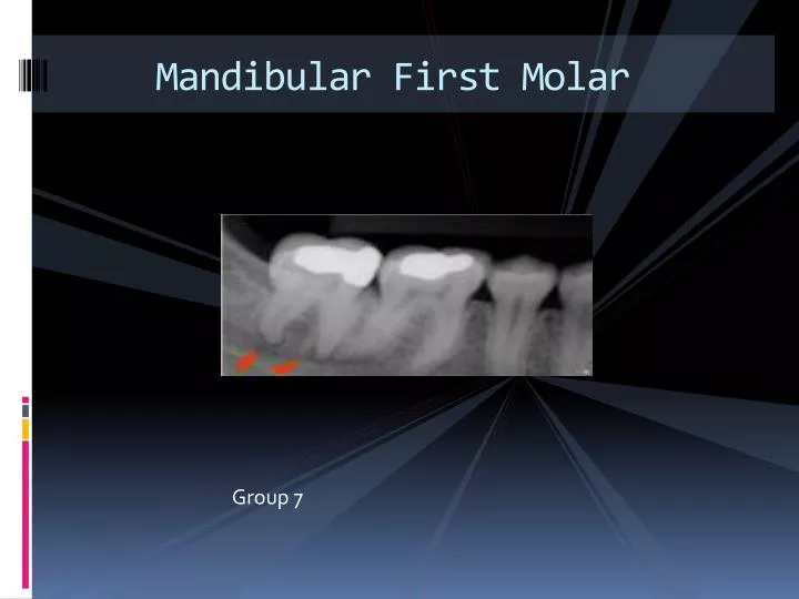 PPT - Mandibular First Molar PowerPoint Presentation, free download ...