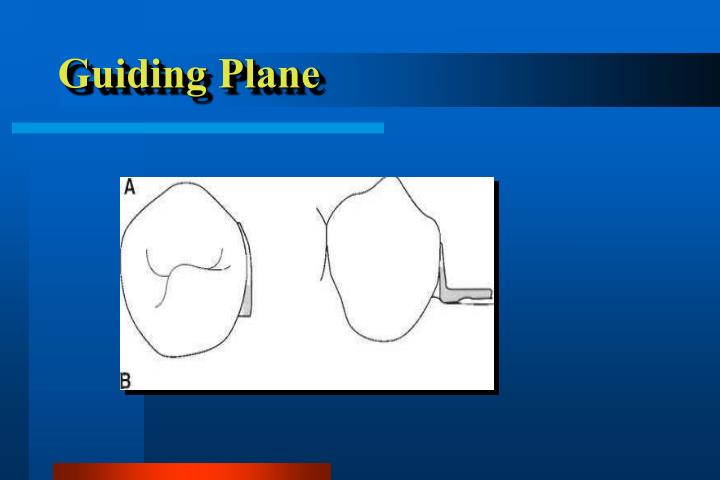 PPT - Principles of RPD Design PowerPoint Presentation - ID:2029079