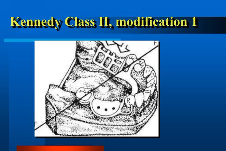 PPT - Principles of RPD Design PowerPoint Presentation - ID:2029079