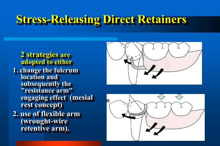 PPT - Principles of RPD Design PowerPoint Presentation - ID:2029079