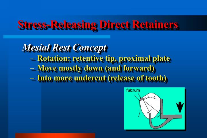PPT - Principles of RPD Design PowerPoint Presentation - ID:2029079