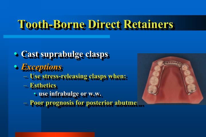 PPT - Principles of RPD Design PowerPoint Presentation - ID:2029079