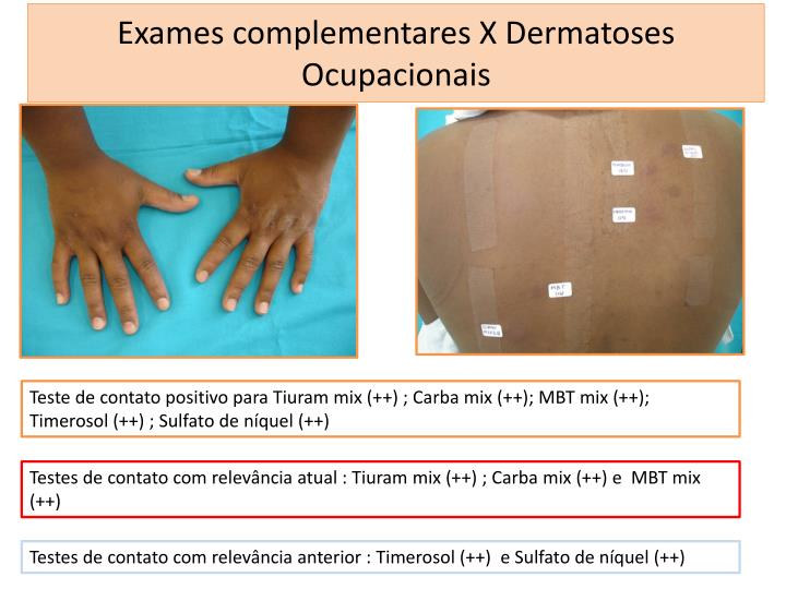 PPT - A importância dos exames complementares no diagnostico e na ...