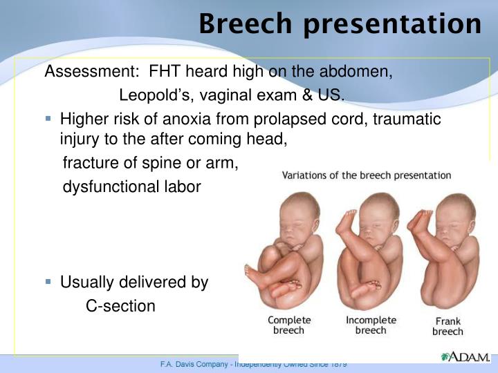 Ppt Chapter 12 Processes And Stages Of Labor And Birth Powerpoint