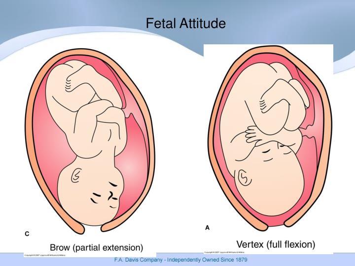Ppt Chapter 12 Processes And Stages Of Labor And Birth Powerpoint