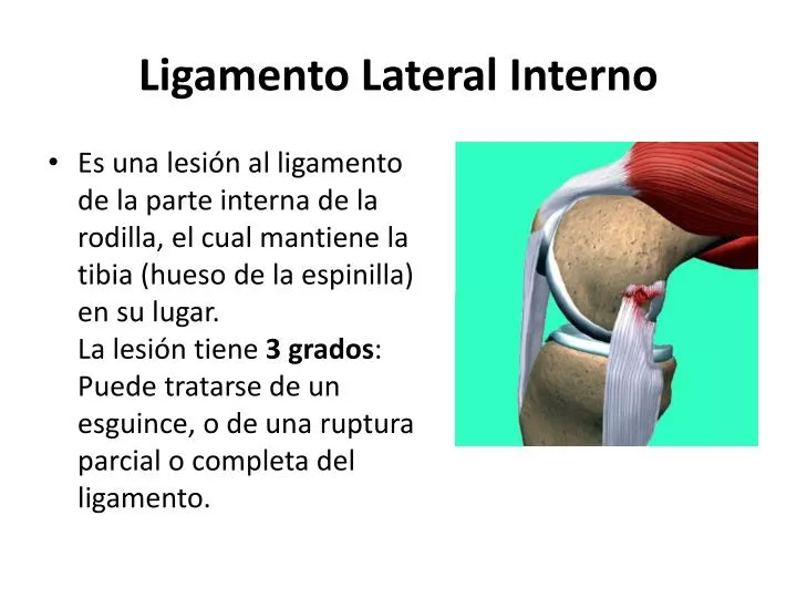 PPT - Ligamento Lateral Interno PowerPoint Presentation - ID:2029982
