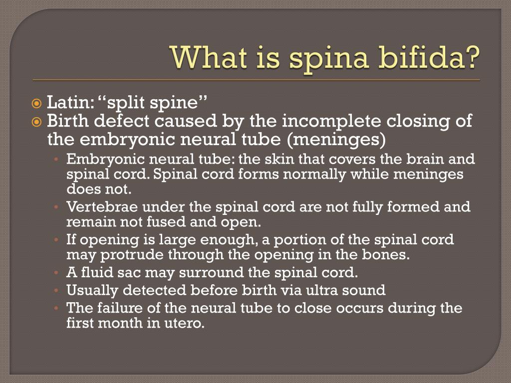 Ppt Spina Bifida Powerpoint Presentation Free Download Id 2030109