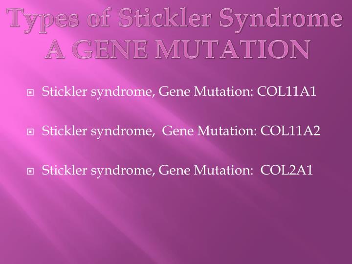 PPT - Sticklers Syndrome PowerPoint Presentation - ID:2031799