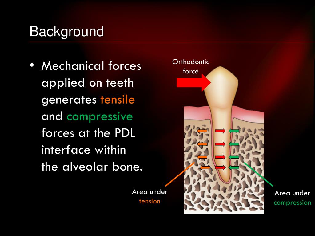 PPT - Protein Expression in Periodontal Ligament Cells Subjected to ...