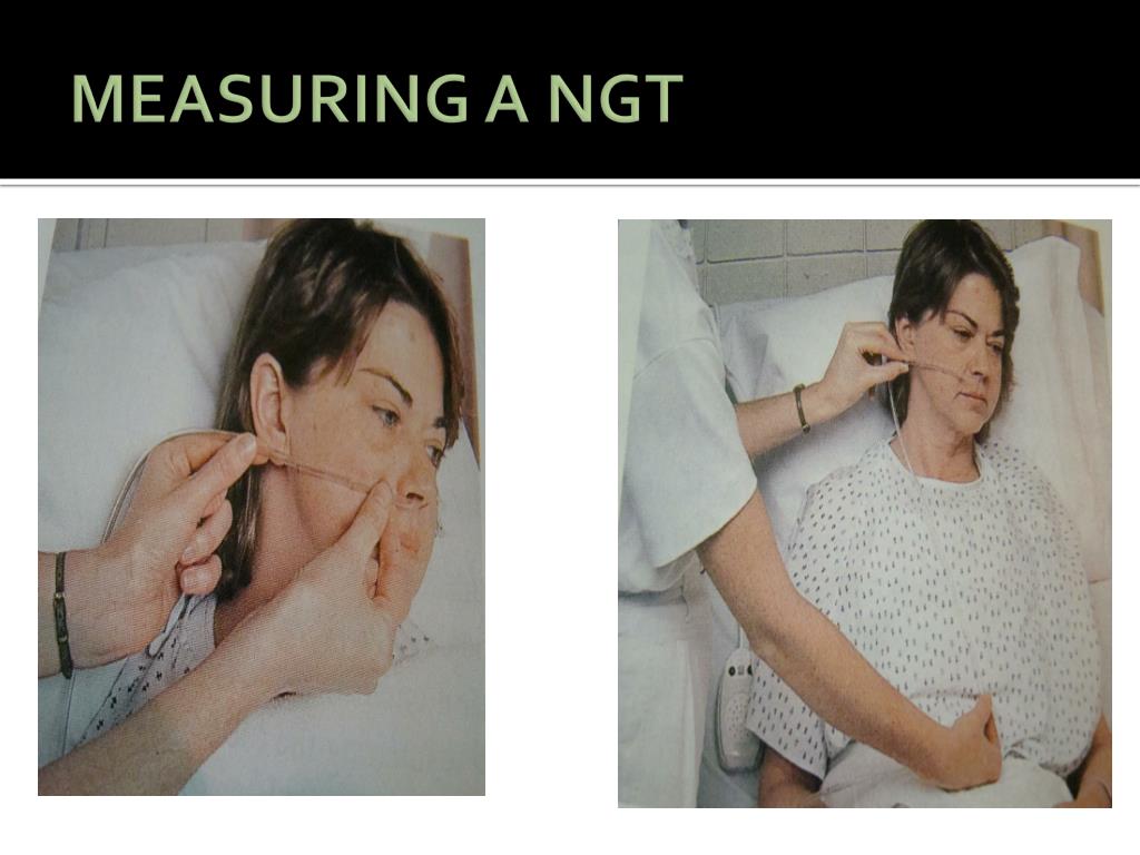 PPT - URINARY CATHETER and GASTRO-INTESTINAL TUBE CARE PowerPoint ...