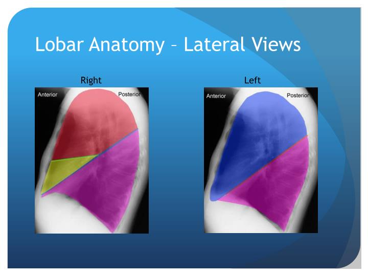 PPT - Chest X-Ray Interpretation for the Internist PowerPoint ...