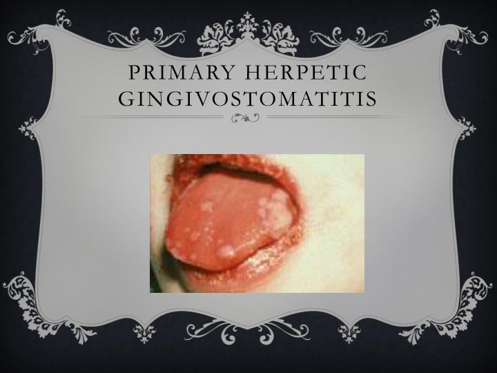 PPT - Oral pathology PowerPoint Presentation - ID:2034835