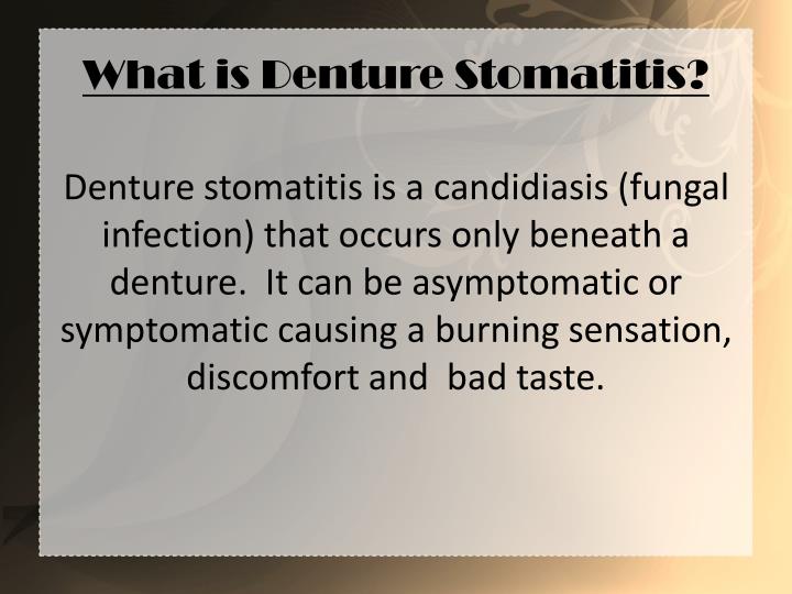 PPT - Denture Stomatitis PowerPoint Presentation - ID:2034905