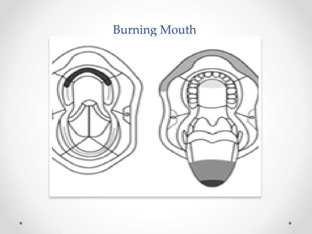 PPT - Differential Diagnosis of Oral and Maxillofacial Diseases for the ...