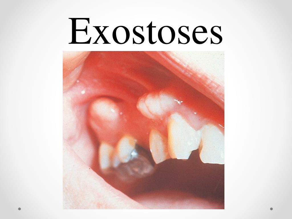 PPT - Differential Diagnosis of Oral and Maxillofacial Diseases for the ...