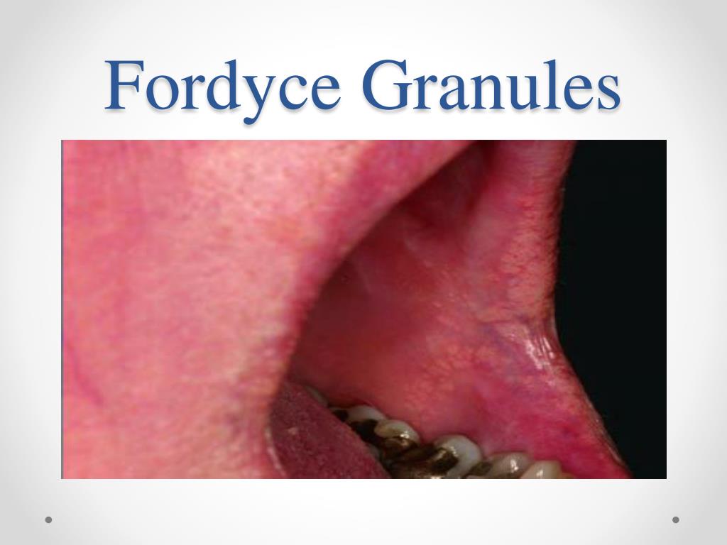 PPT - Differential Diagnosis of Oral and Maxillofacial Diseases for the ...