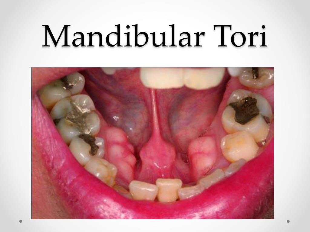 PPT - Differential Diagnosis of Oral and Maxillofacial Diseases for the ...