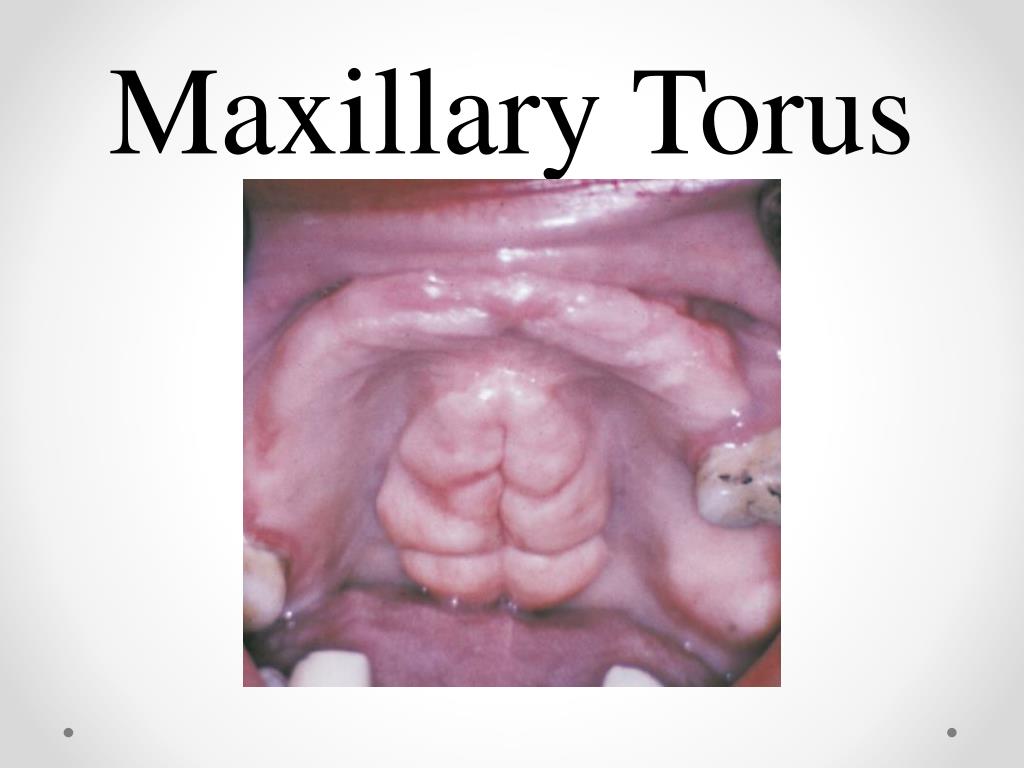PPT - Differential Diagnosis of Oral and Maxillofacial Diseases for the ...