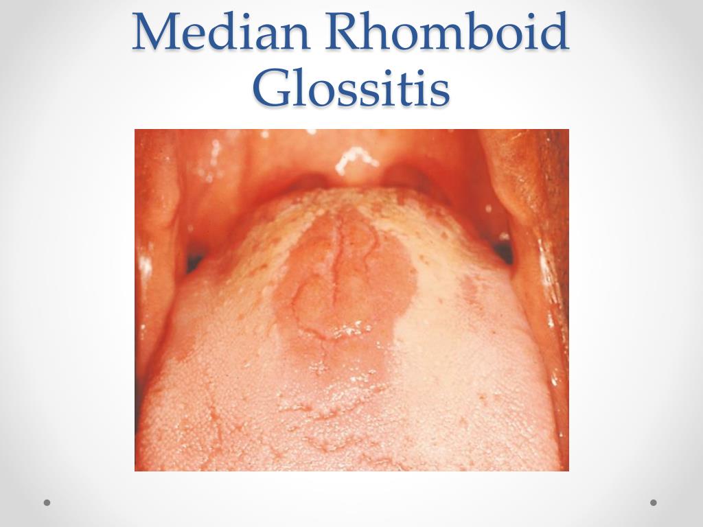 PPT - Differential Diagnosis of Oral and Maxillofacial Diseases for the ...