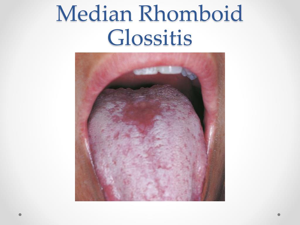 PPT - Differential Diagnosis of Oral and Maxillofacial Diseases for the ...