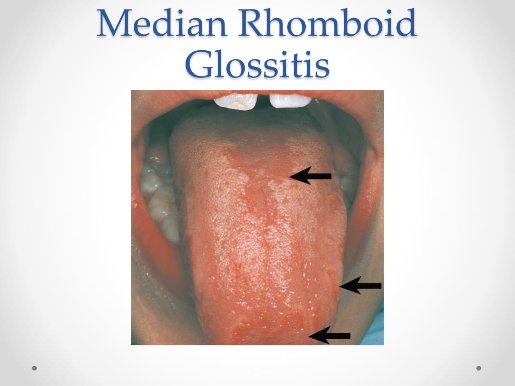 PPT - Differential Diagnosis of Oral and Maxillofacial Diseases for the ...