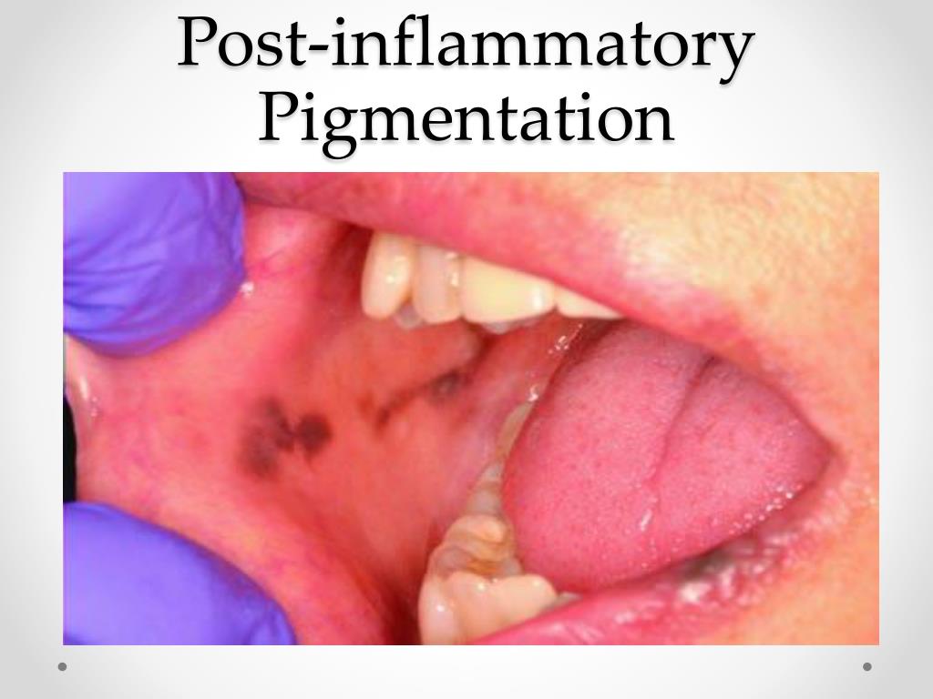 PPT - Differential Diagnosis of Oral and Maxillofacial Diseases for the ...