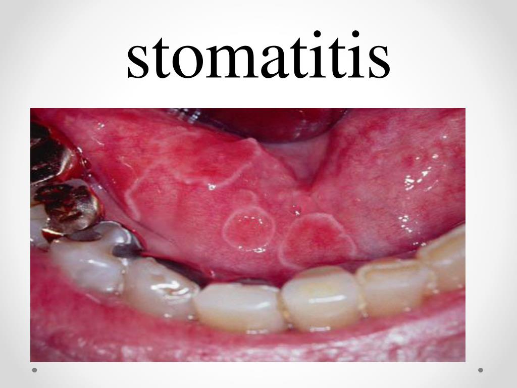 PPT - Differential Diagnosis of Oral and Maxillofacial Diseases for the ...