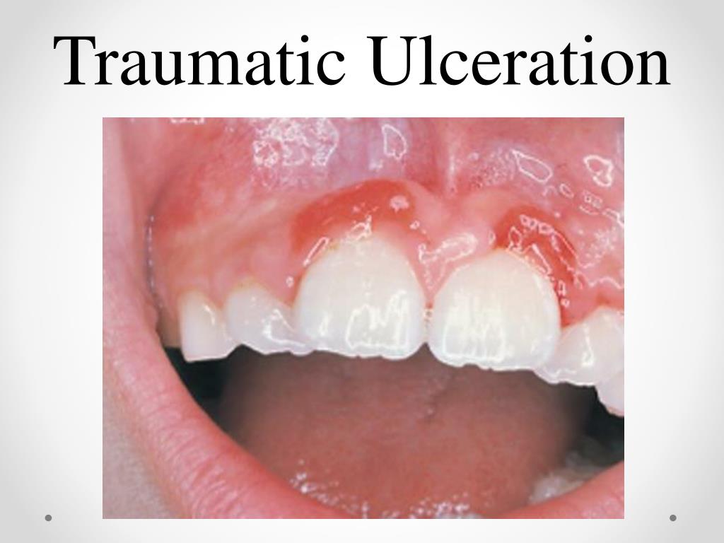 PPT - Differential Diagnosis of Oral and Maxillofacial Diseases for the ...