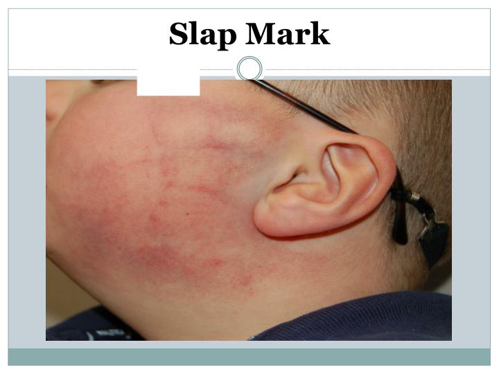 PPT - California Mandated Reporter Training PowerPoint Presentation ...