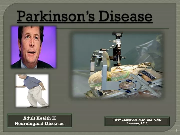 PPT - Parkinson’s Disease PowerPoint Presentation, free download - ID ...
