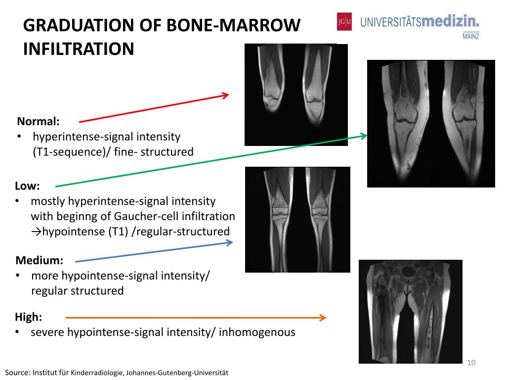 PPT - Larissa Moos, Jörg Reinke, Miriam Brixius -Huth, Eugen Mengel and ...