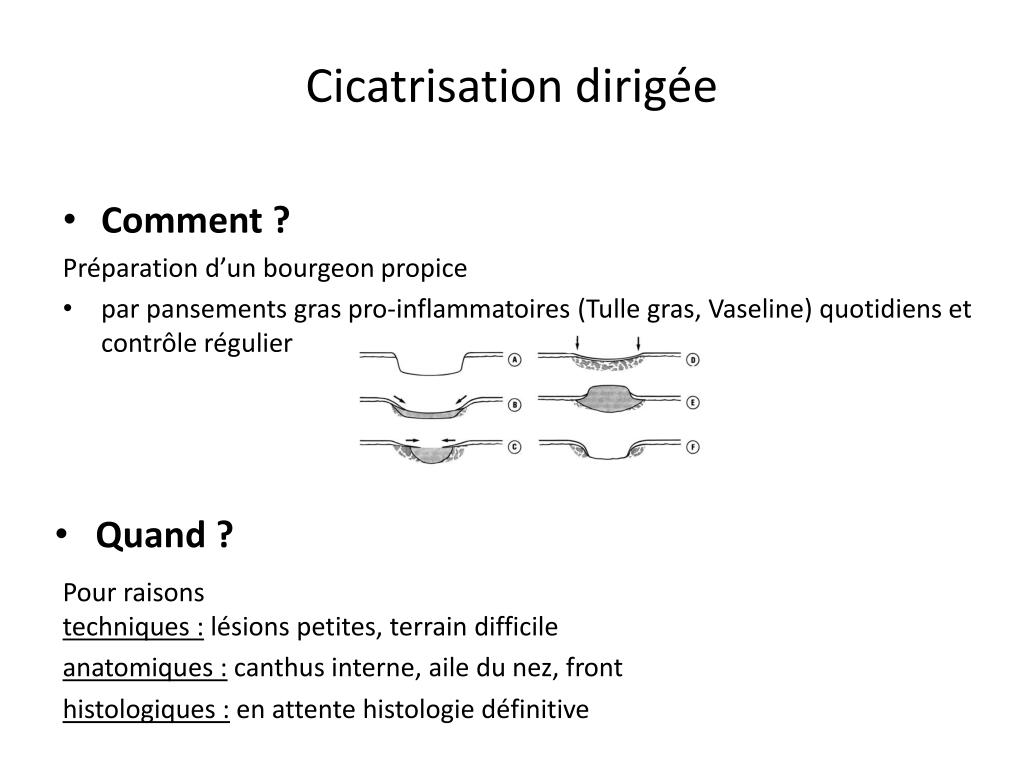 PPT - Prise en charge chirurgicale des tumeurs cutanées faciales ...