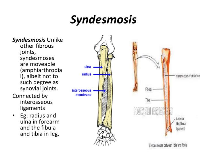 PPT - Joints or Articulations PowerPoint Presentation - ID:2038133