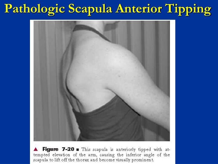 PPT - What is the Shoulder girdle? PowerPoint Presentation - ID:2038334