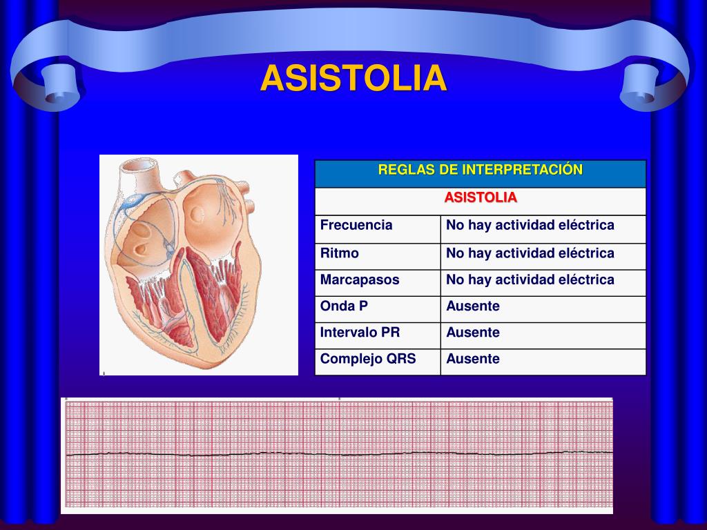 PPT - MANEJO PREHOSPITALARIO DE LAS ARRITMIAS LETALES. PowerPoint ...