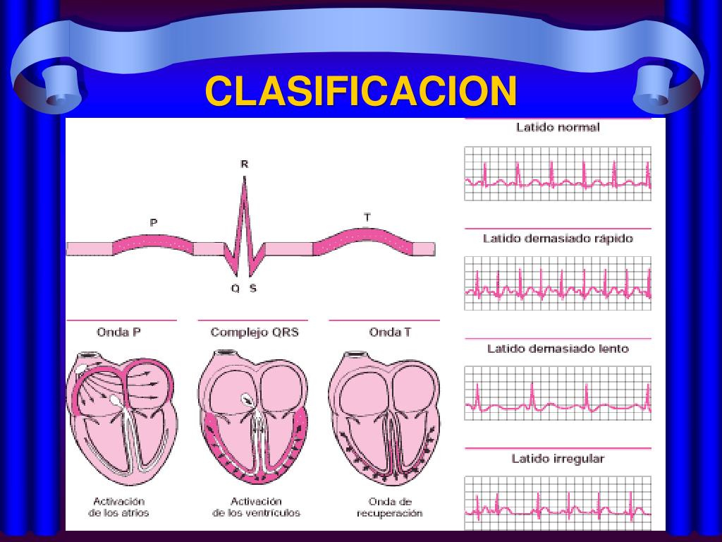 PPT - MANEJO PREHOSPITALARIO DE LAS ARRITMIAS LETALES. PowerPoint Presentation - ID:2038860