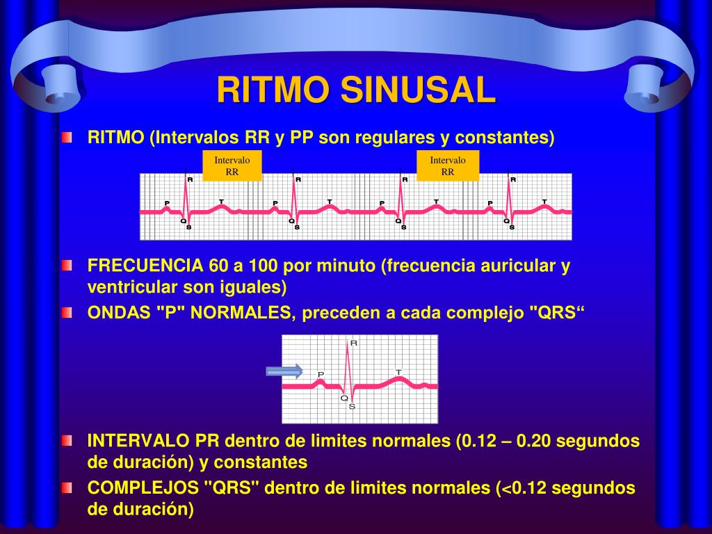 PPT - MANEJO PREHOSPITALARIO DE LAS ARRITMIAS LETALES. PowerPoint ...