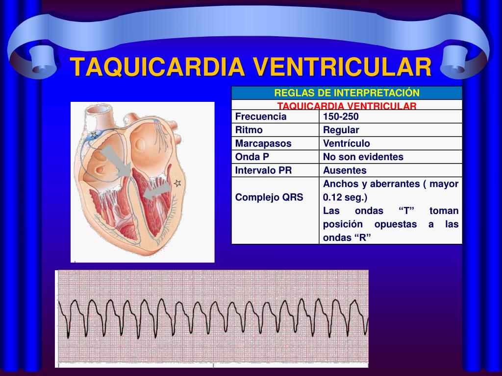 PPT - MANEJO PREHOSPITALARIO DE LAS ARRITMIAS LETALES. PowerPoint ...