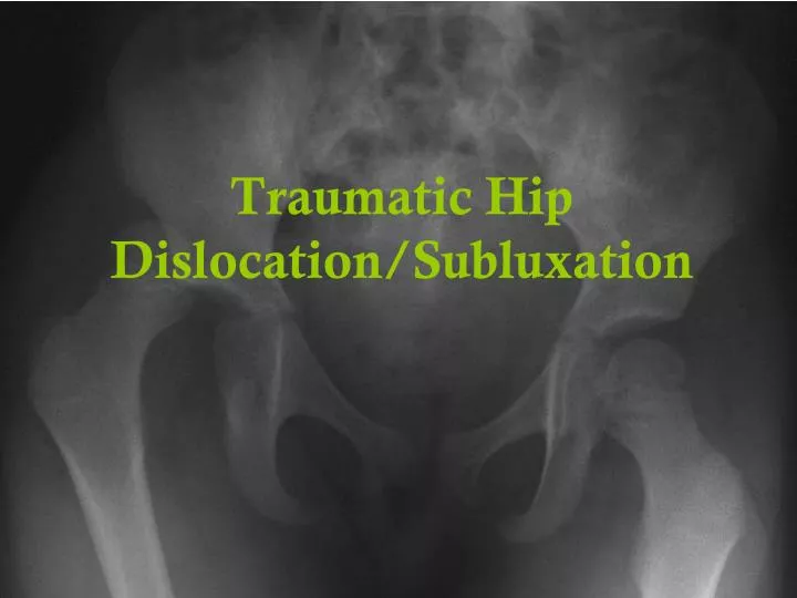PPT - Traumatic Hip Dislocation/Subluxation PowerPoint Presentation ...