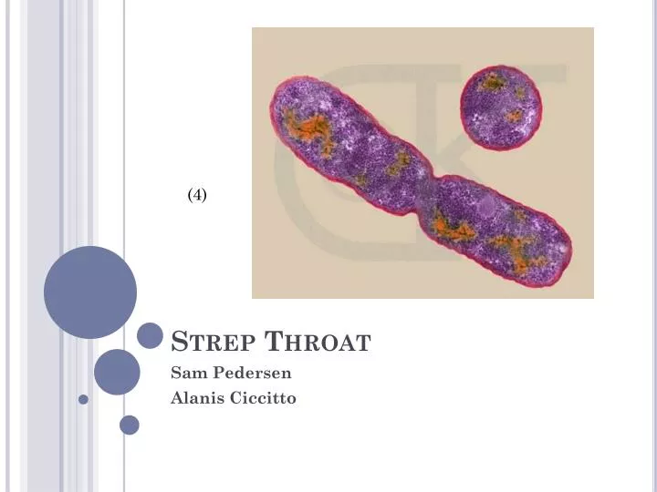 PPT - Strep Throat PowerPoint Presentation, free download - ID:2044443