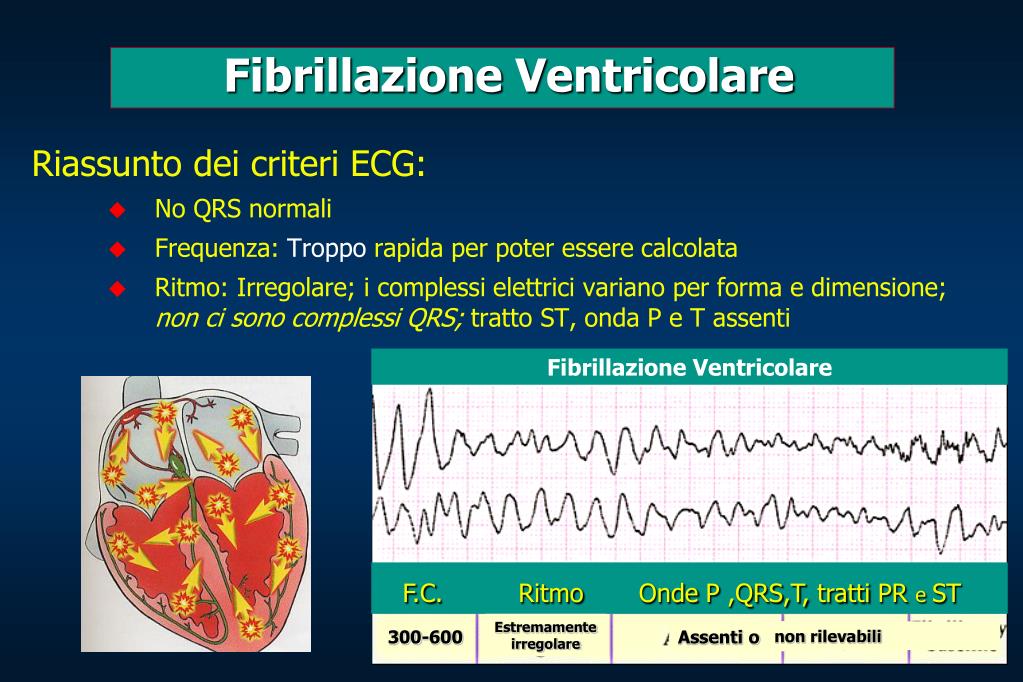 PPT - FISIOPATOLOGIA DELL’ARRESTO CARDIO RESPIRATORIO IMPROVVISO ...