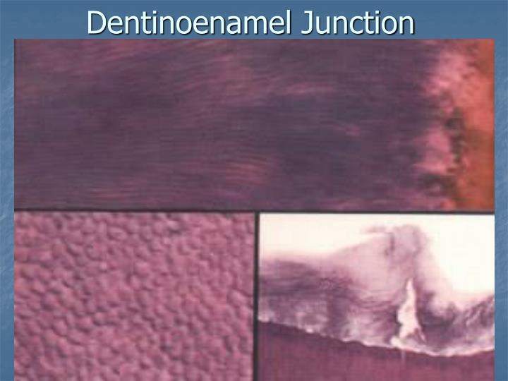 PPT - Enamel : Composition , Formation , and Structure PowerPoint ...