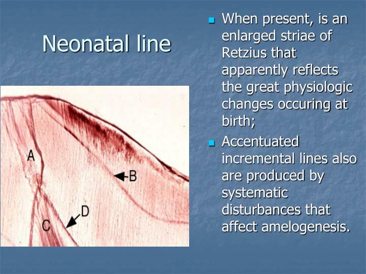 PPT - Enamel : Composition , Formation , and Structure PowerPoint ...