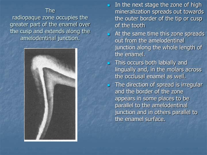 PPT - Enamel : Composition , Formation , and Structure PowerPoint ...