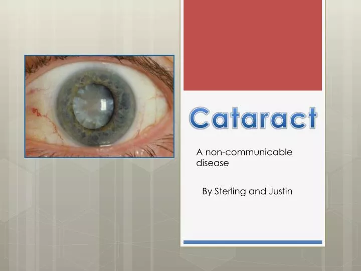 PPT - Cataract PowerPoint Presentation, free download - ID:2046011