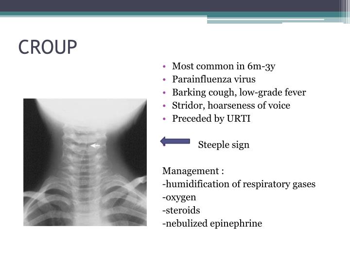 PPT - STRIDOR PowerPoint Presentation - ID:2046111