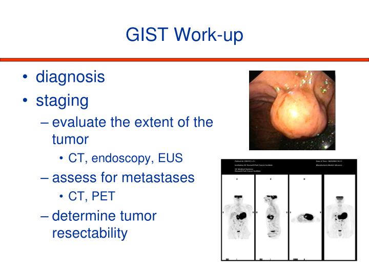 PPT - The Surgeon’s Role in the Management of Gastrointestinal Stromal ...