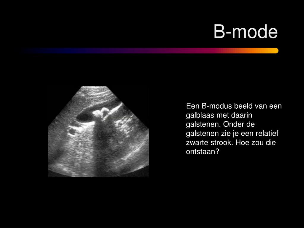 PPT - Ultrasound = echografie PowerPoint Presentation, free download ...